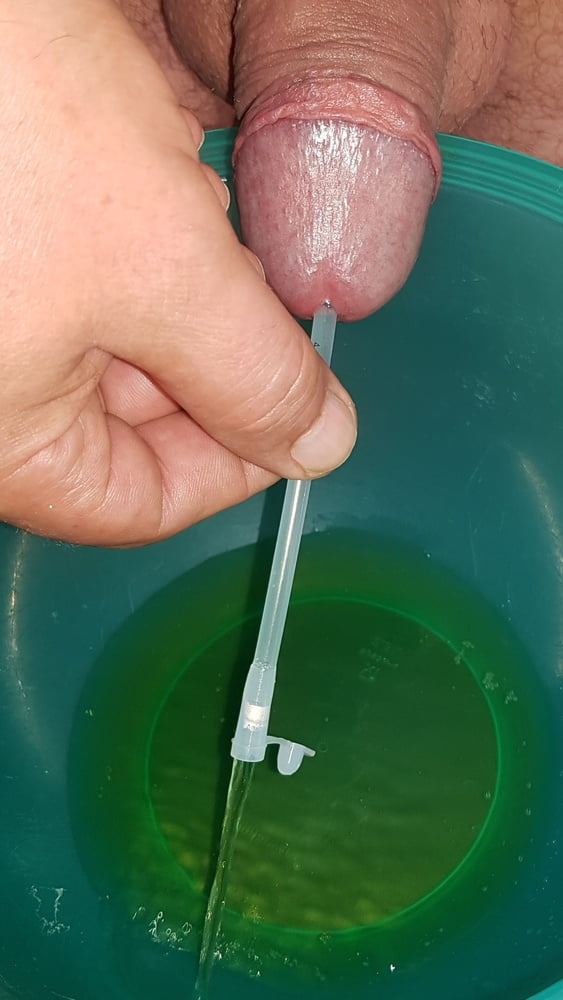 Catheter Insertion 111 Pics Xhamster