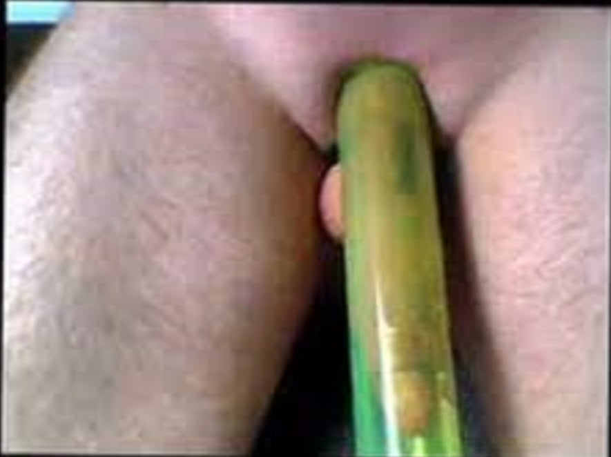 Cock Vacuum Pumping 9 Pics Xhamster 